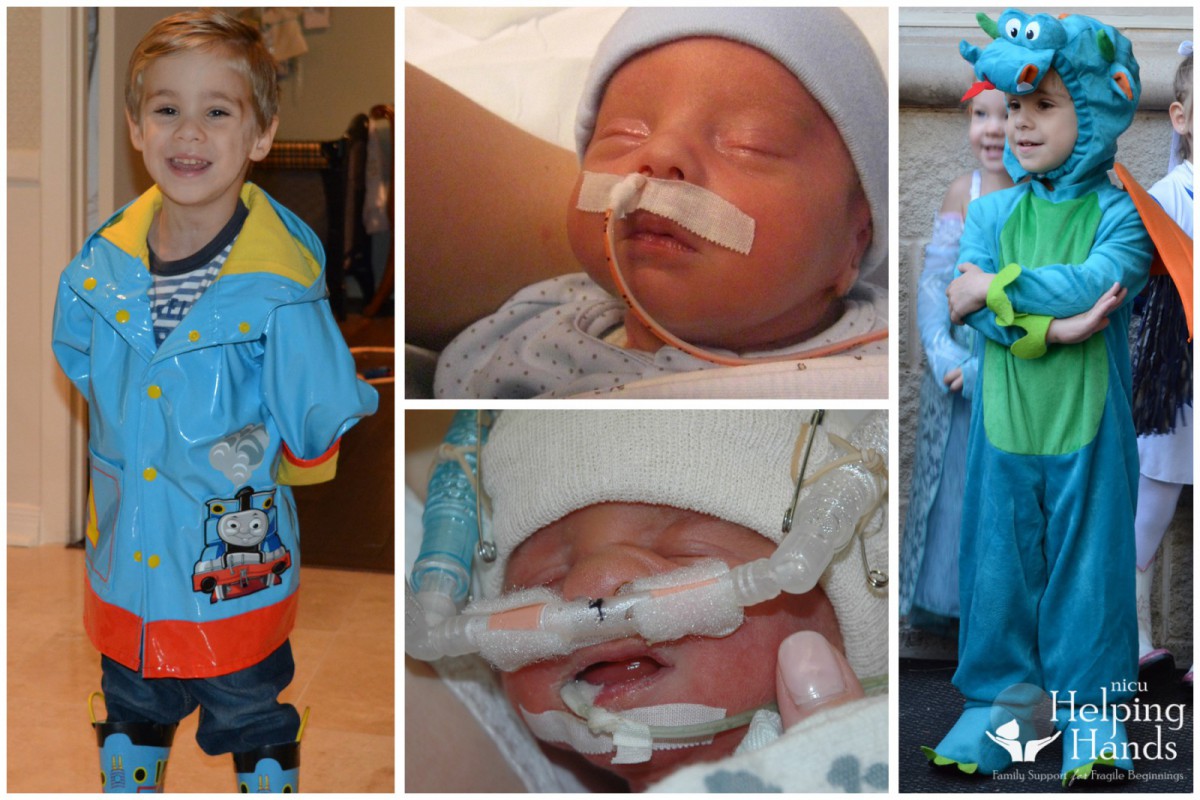 Prune Belly Syndrome Archives • Nicu Helping Hands